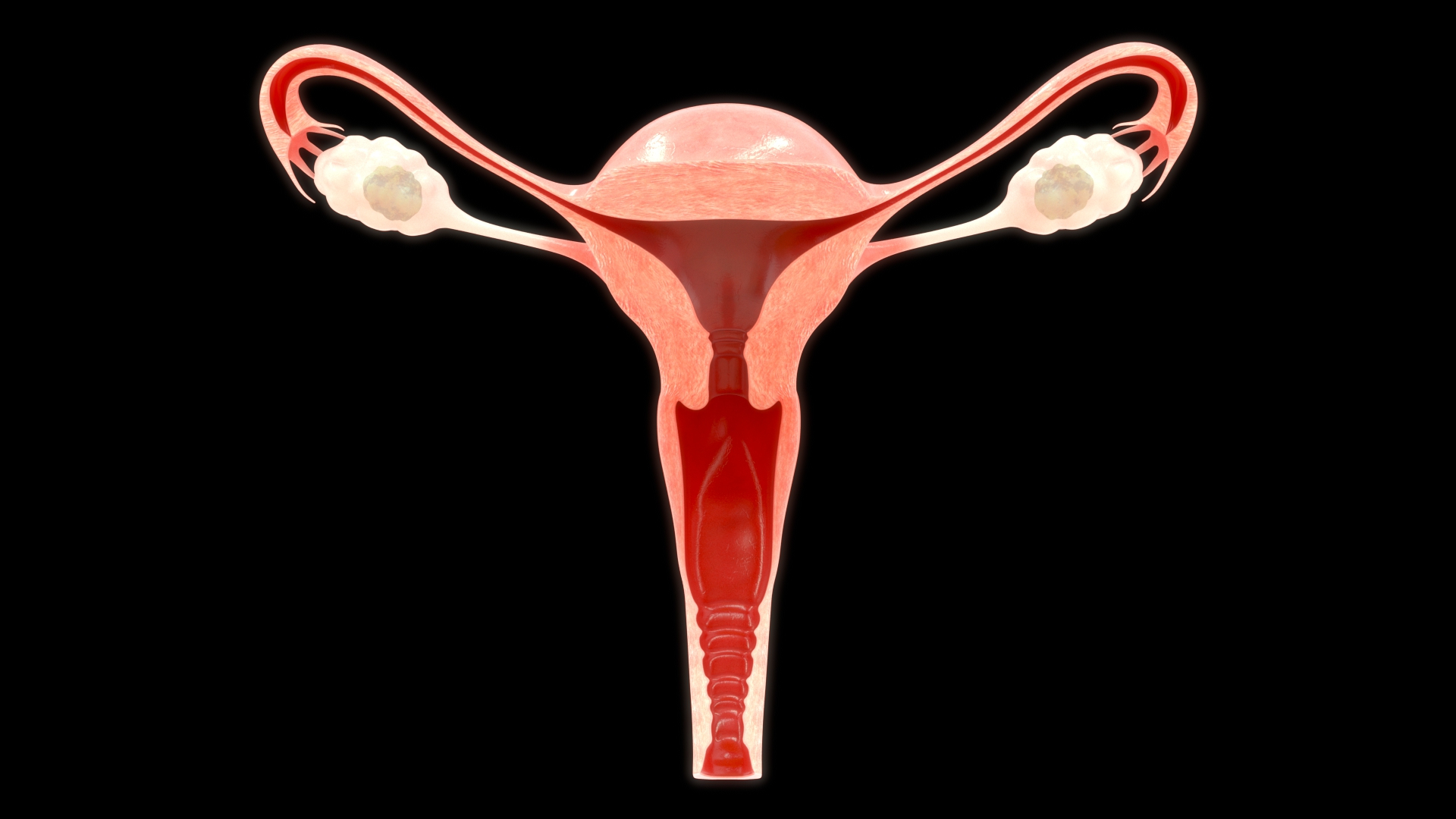 3D Oophorectomy - TurboSquid 2309898