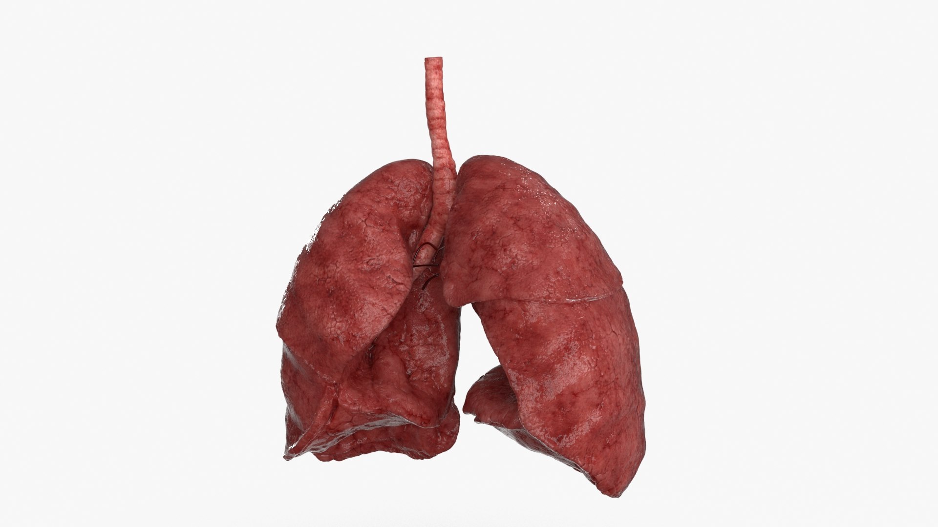 Trachea lung lungs alveoli bronchus bronchi scan scanned ctscan ct ...