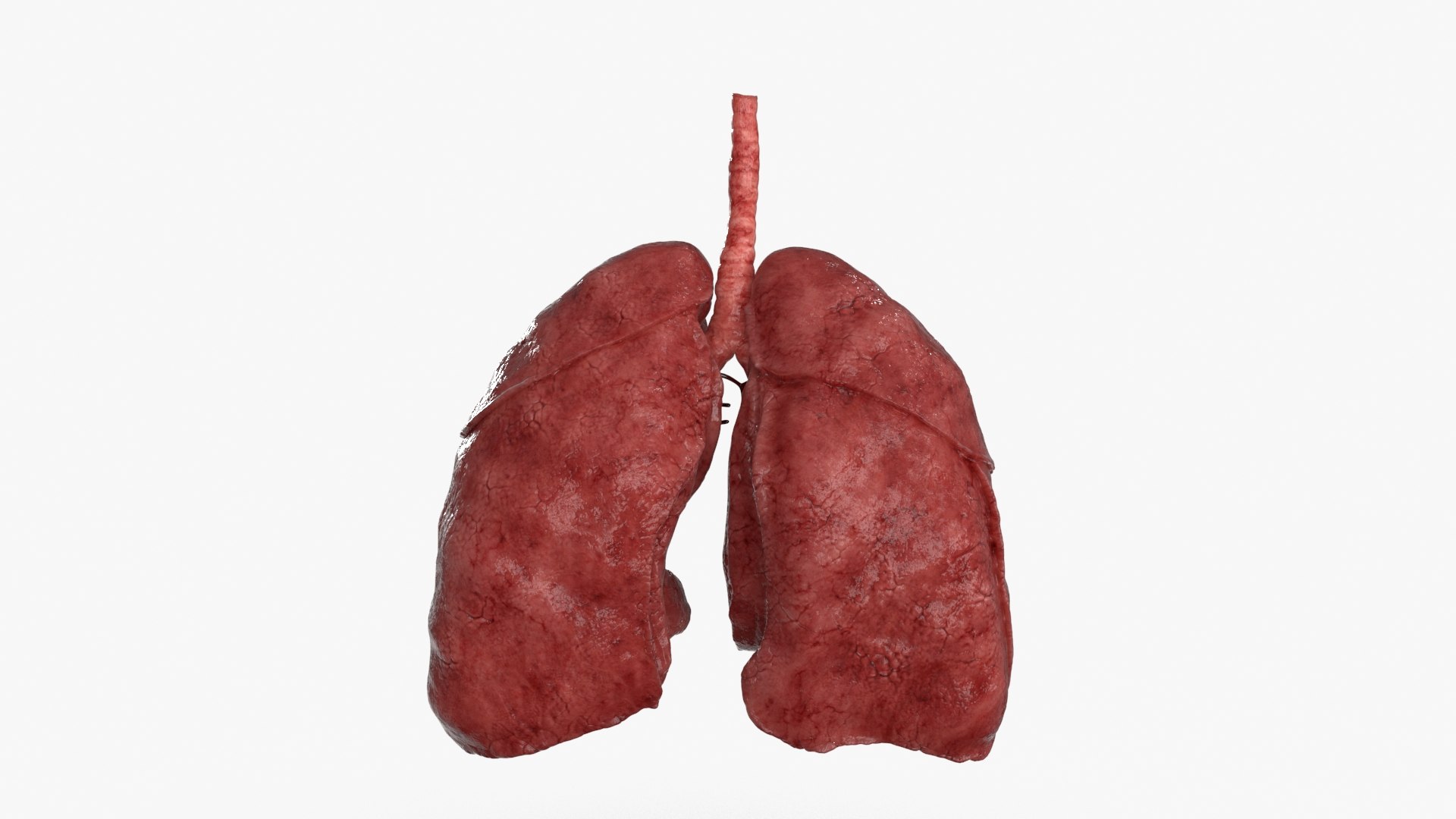 Trachea lung lungs alveoli bronchus bronchi scan scanned ctscan ct ...