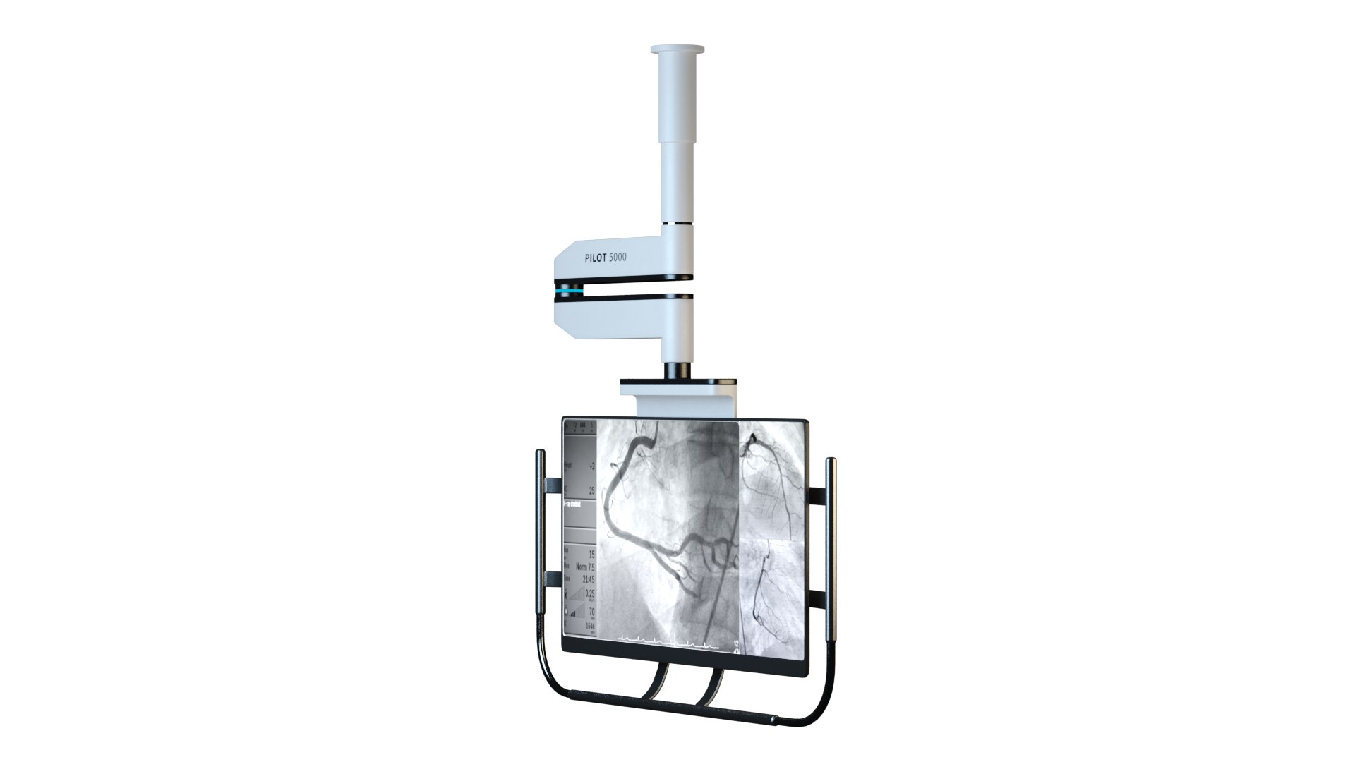 3D Angiography Imagine Monitor Model - TurboSquid 2269780