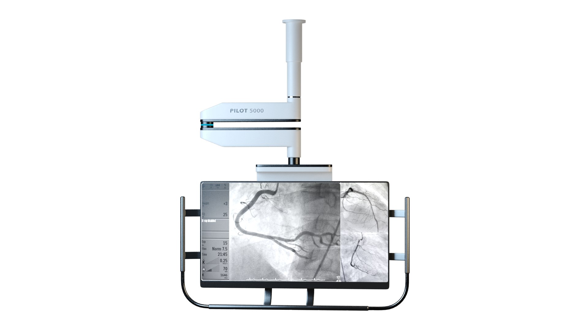 3D Angiography Imagine Monitor Model - TurboSquid 2269780
