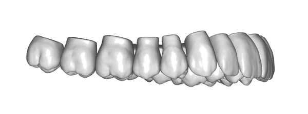 3d upper lower jaw teeth anatomy model
