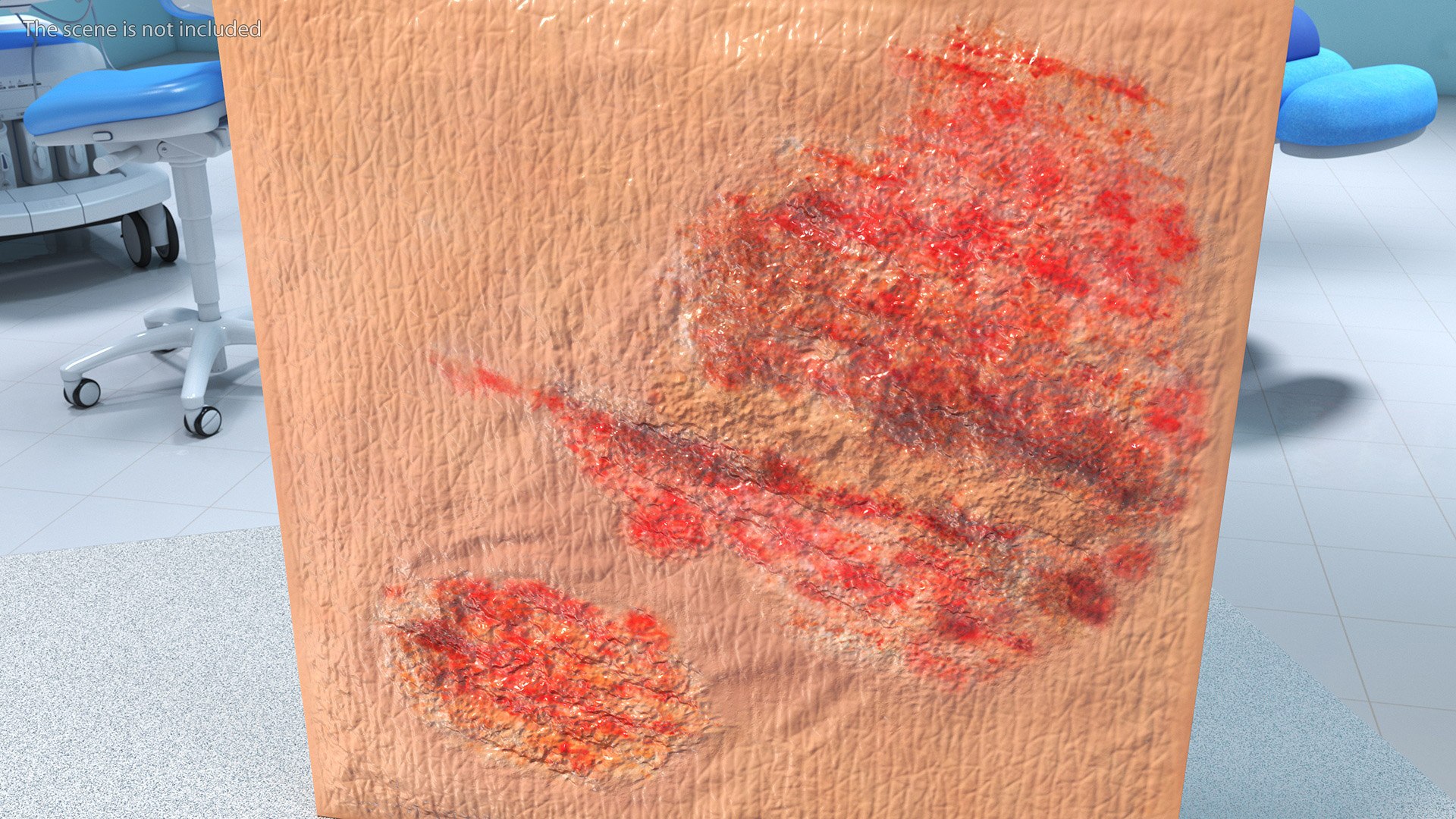 3D Grazed Skin - TurboSquid 2161287