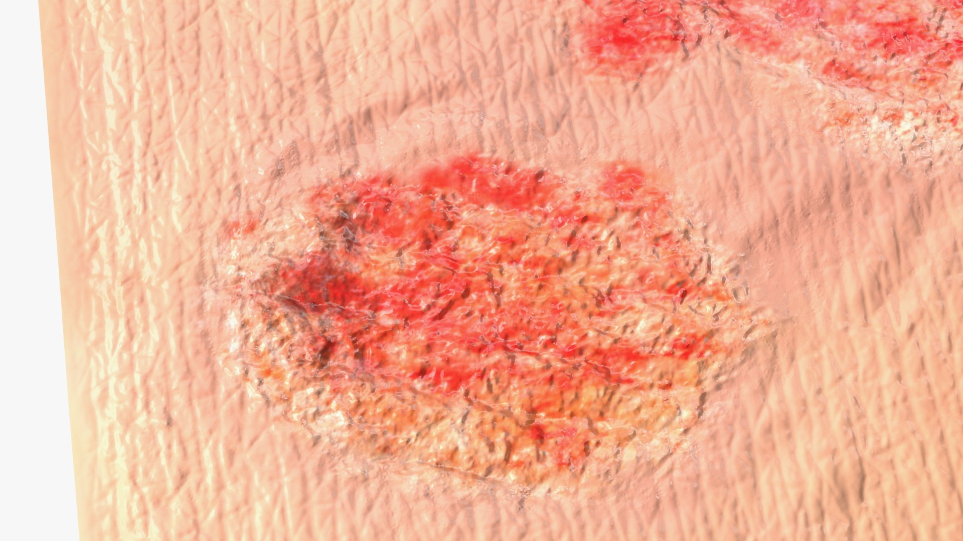 3D Grazed Skin - TurboSquid 2161287