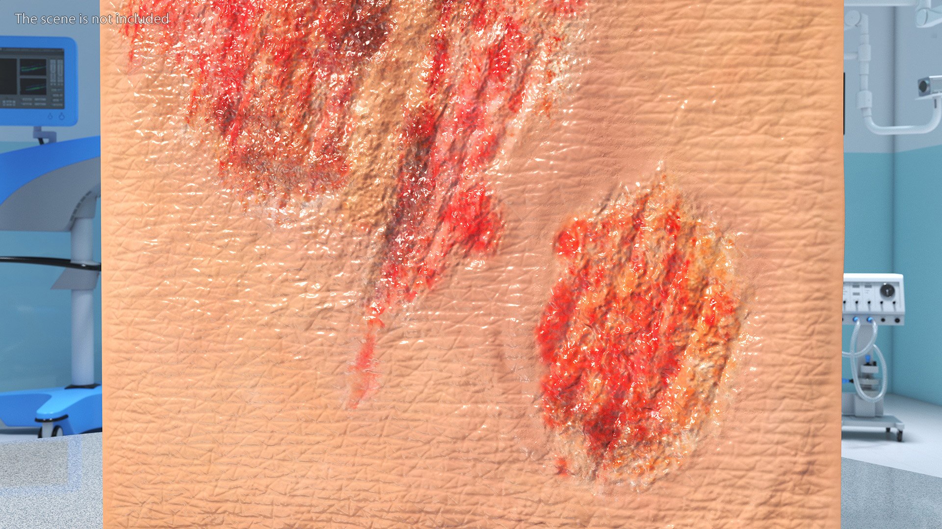 3D Grazed Skin - TurboSquid 2161287