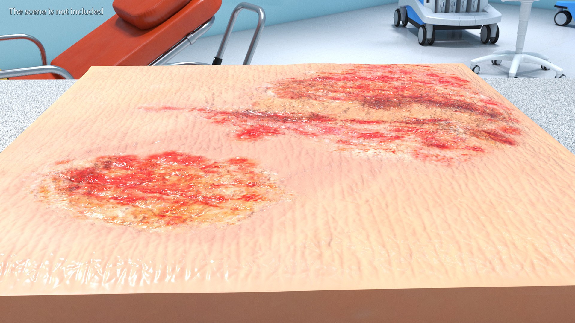 3D Grazed Skin - TurboSquid 2161287