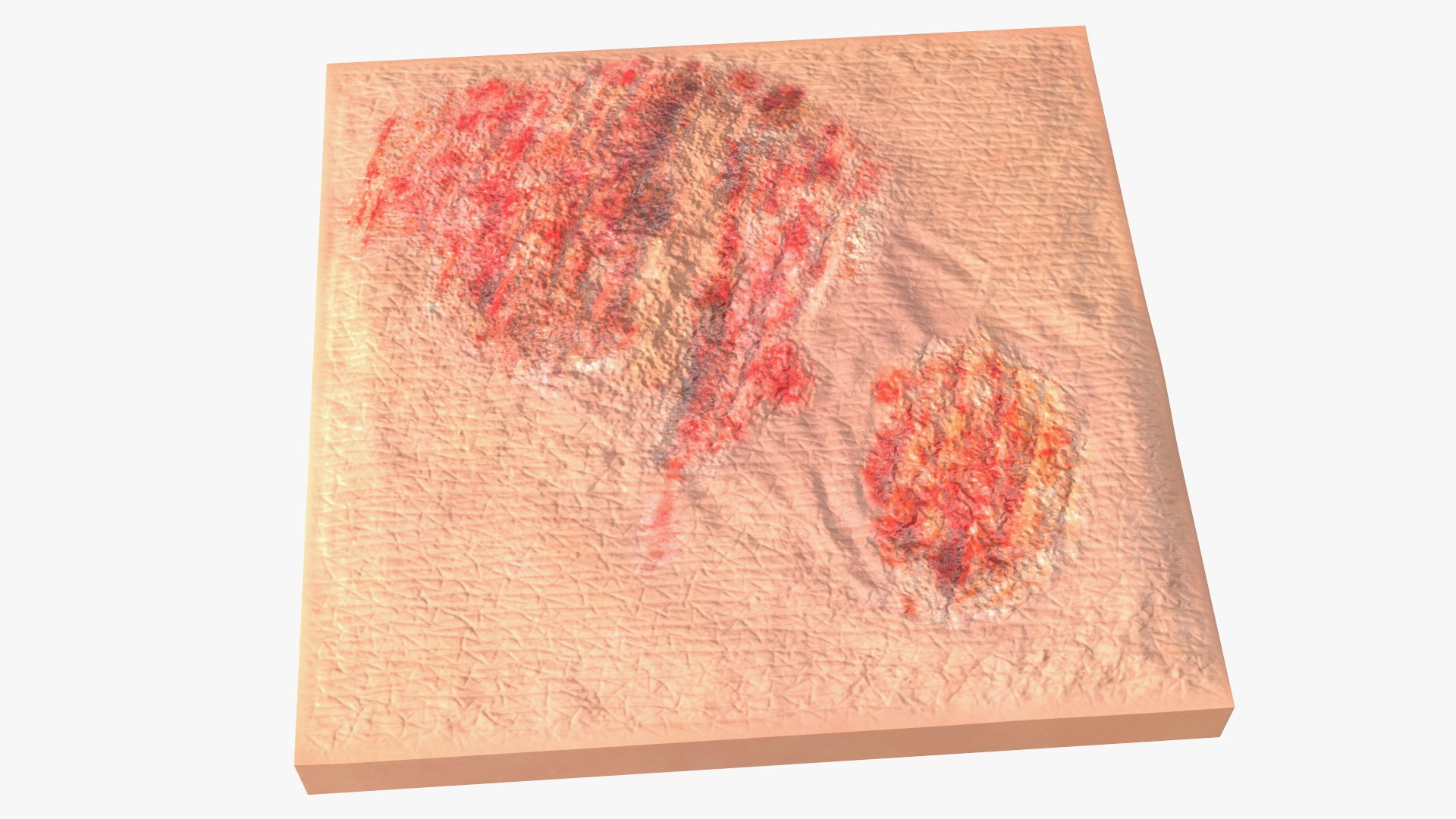 3D Grazed Skin - TurboSquid 2161287