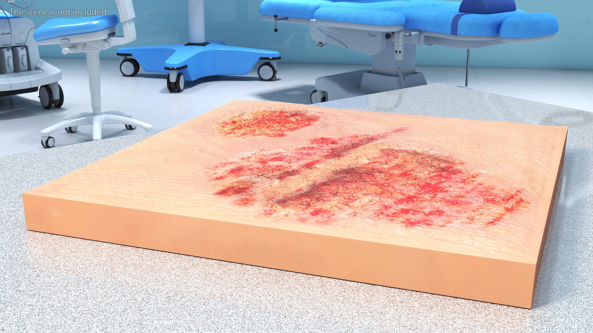 3D Grazed Skin - TurboSquid 2161287