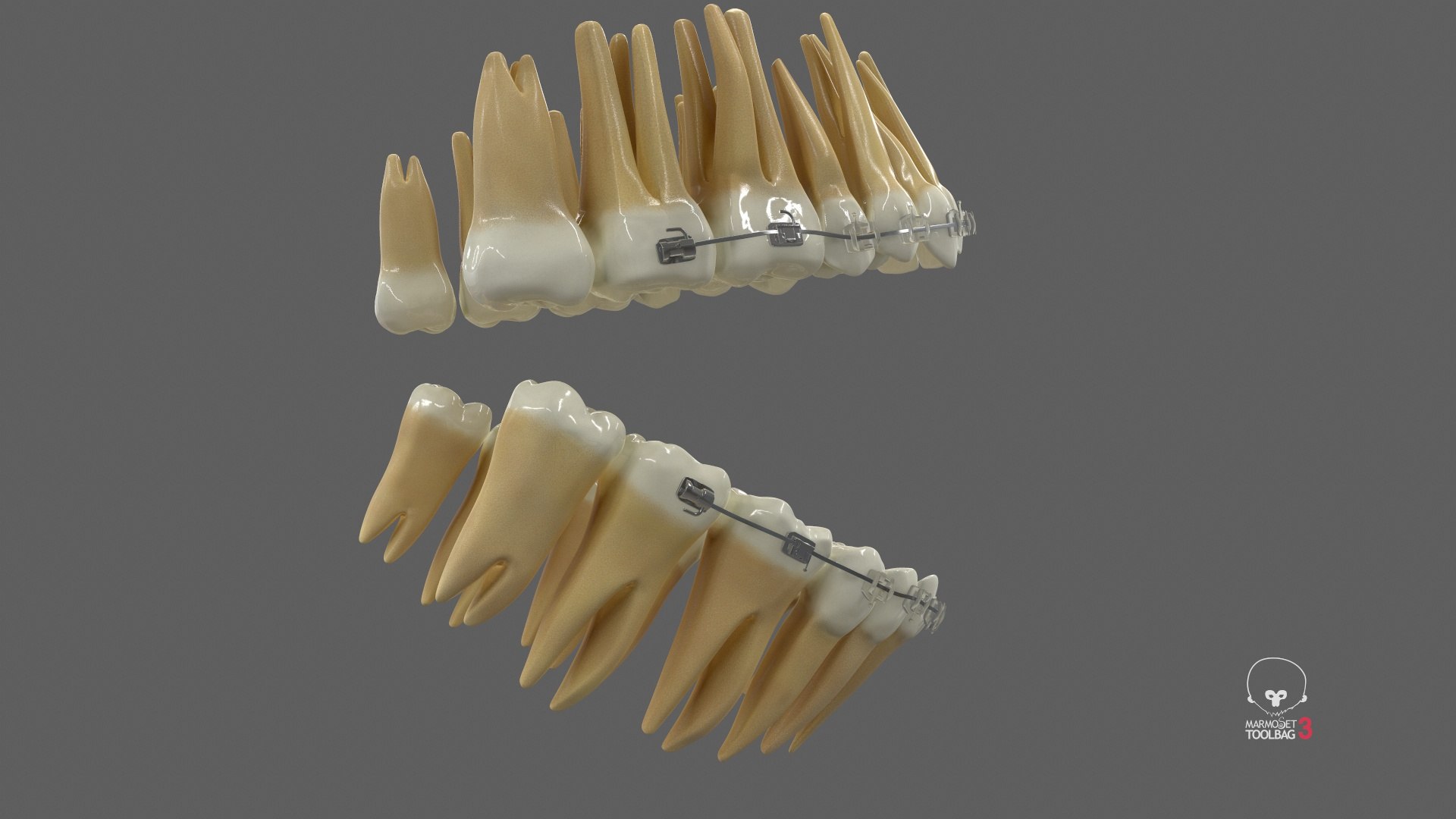 3D Human Teeth With Transparent Dental Braces V04 Model - TurboSquid ...
