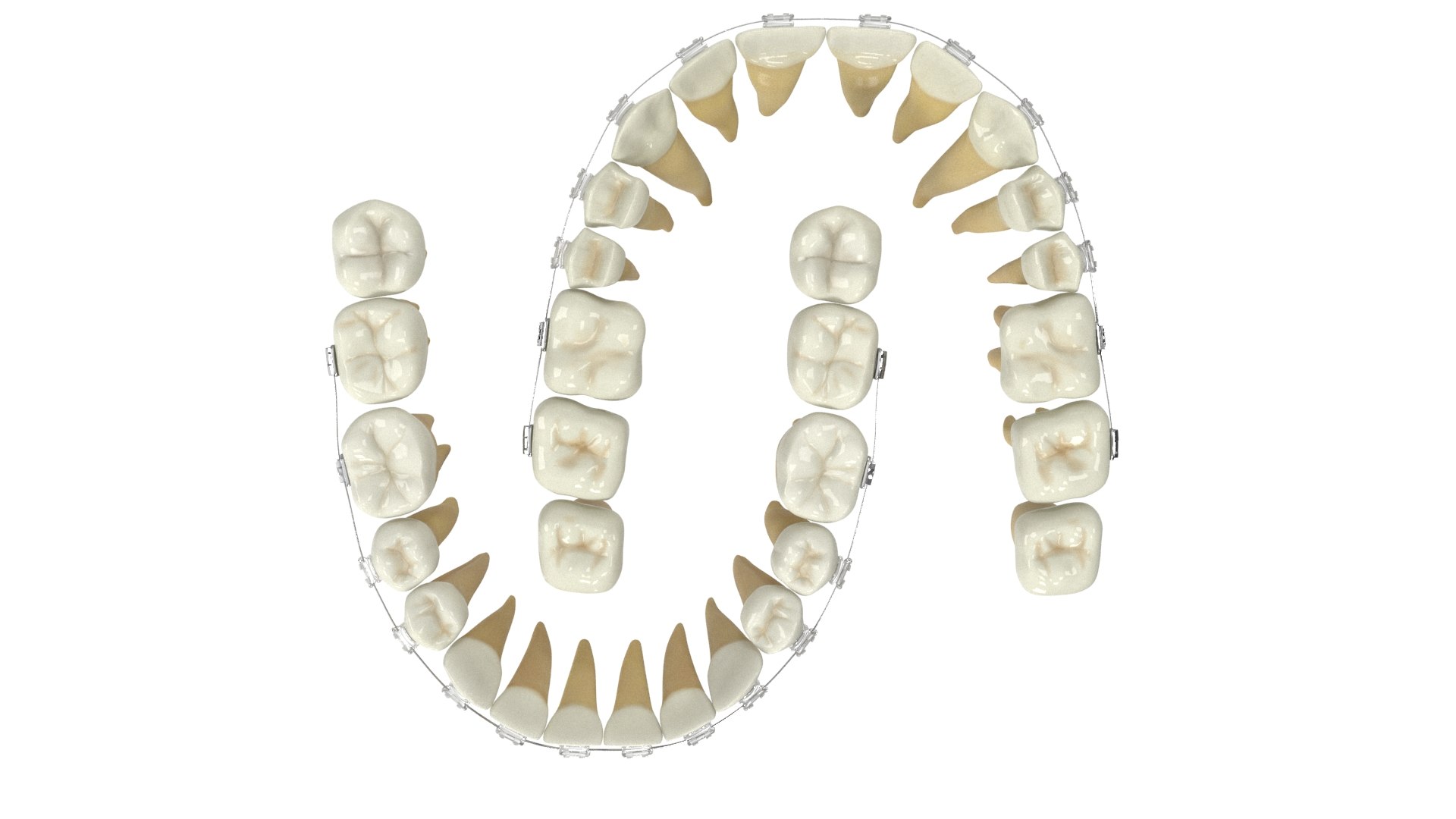 3D Human Teeth With Transparent Dental Braces V04 Model - TurboSquid ...