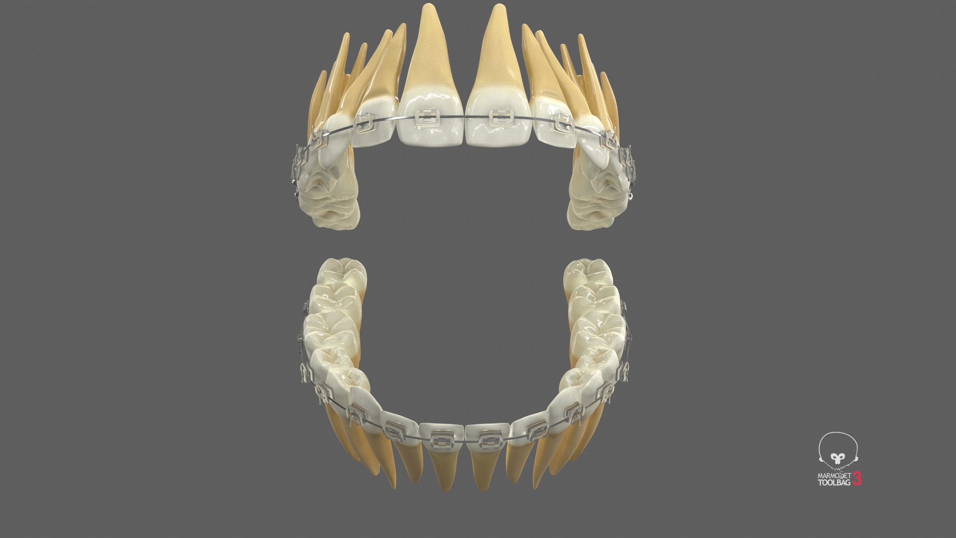 3D Human Teeth With Transparent Dental Braces V04 Model - TurboSquid ...