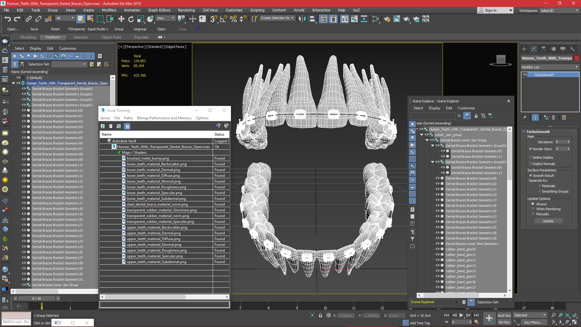 3D Human Teeth With Transparent Dental Braces V04 Model - TurboSquid ...