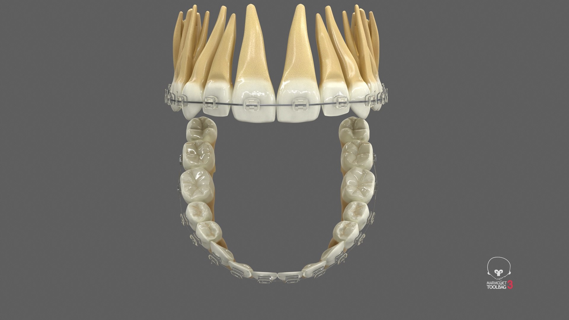 3D Human Teeth With Transparent Dental Braces V04 Model - TurboSquid ...