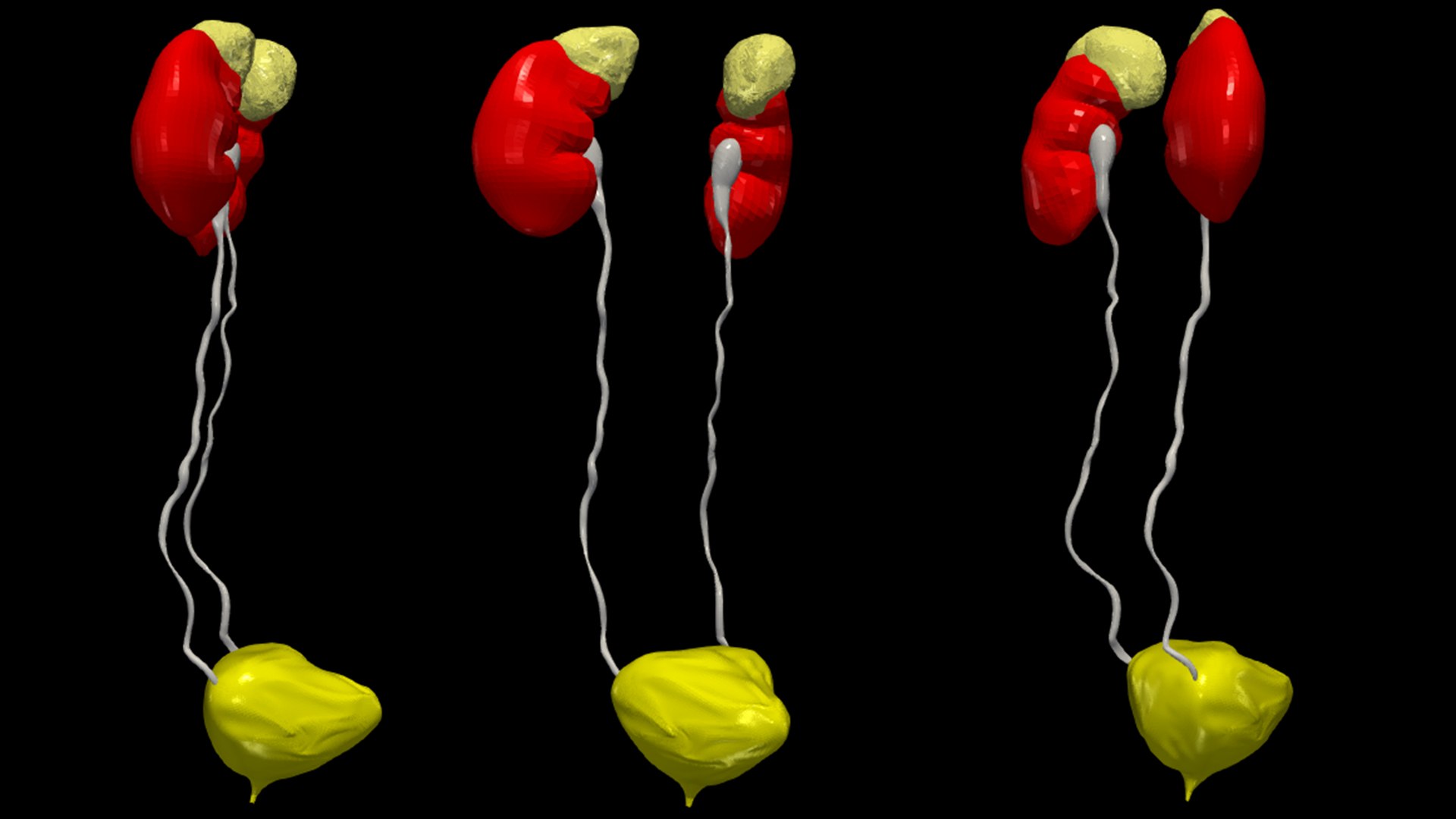 3D Model Of Urinary System Model - TurboSquid 2076873