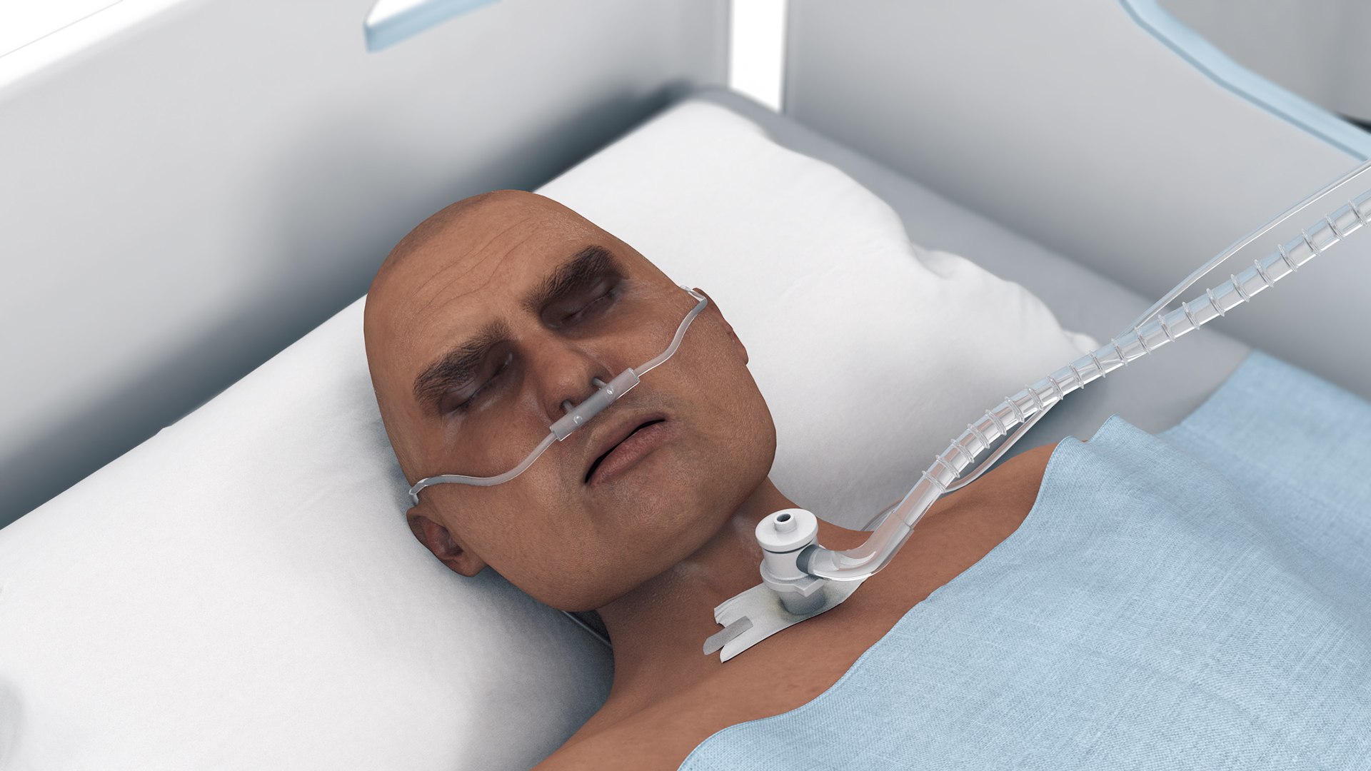 Patient On Ventilator 3D - TurboSquid 2114459