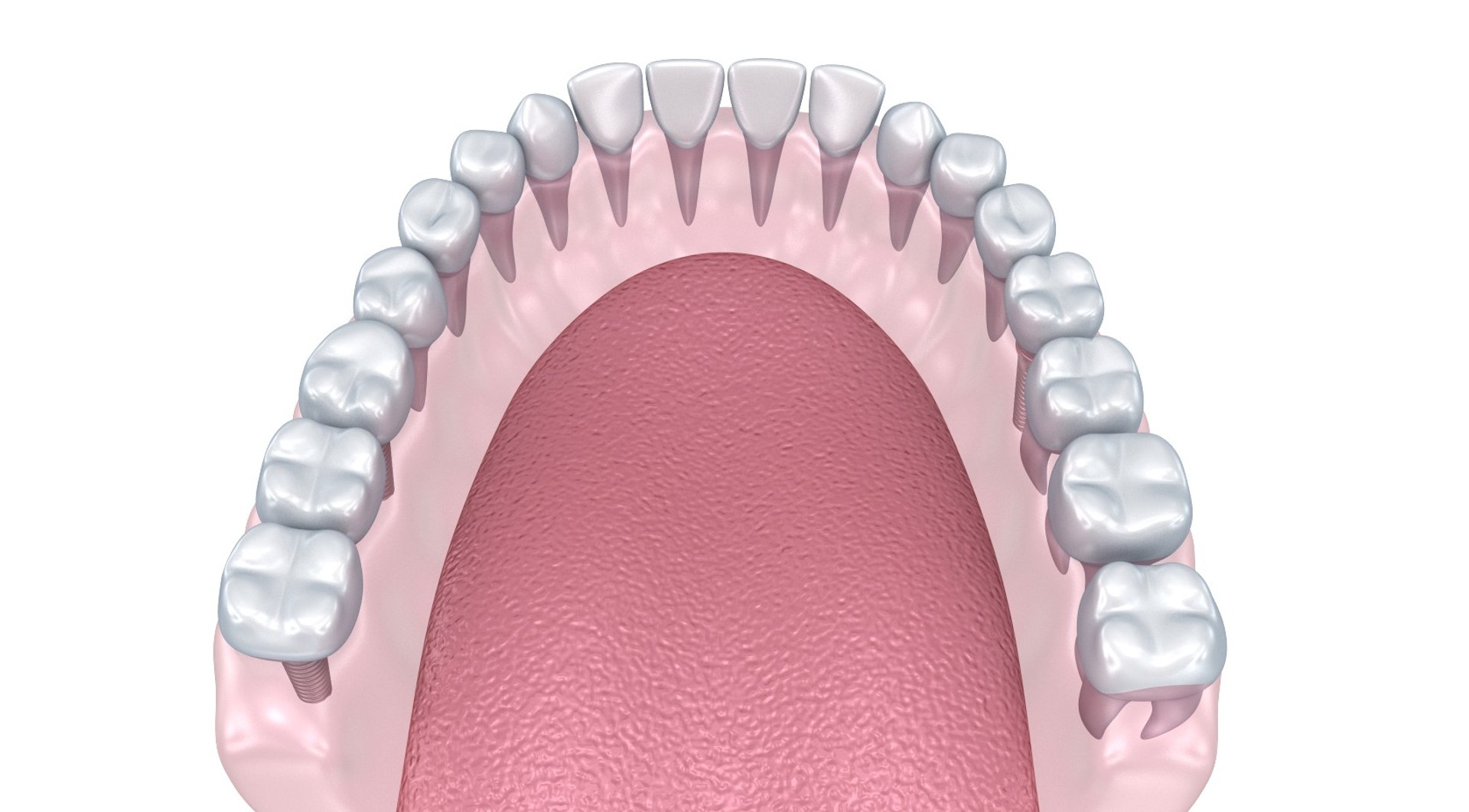 Lower Teeth Crown Dental 3d Max