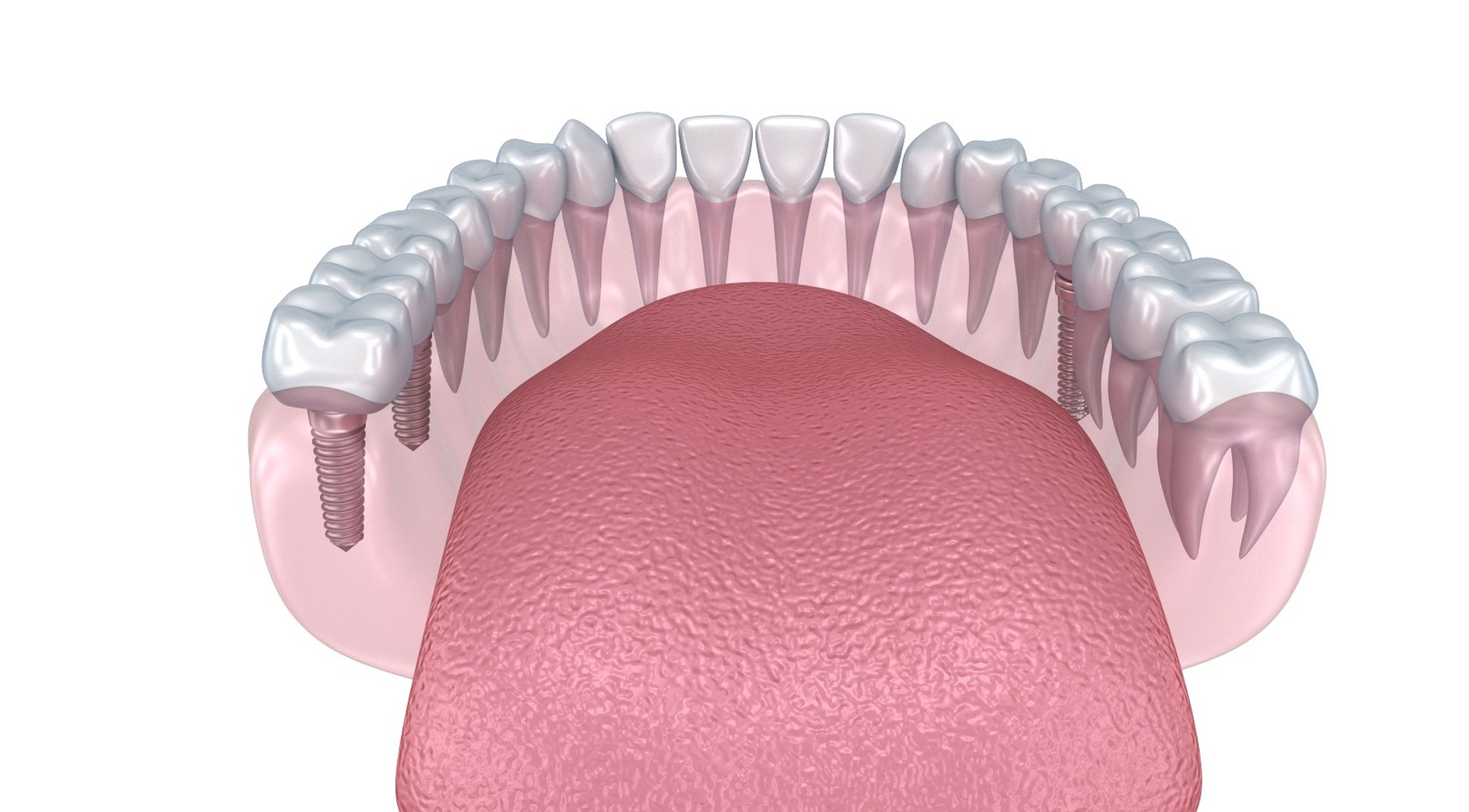 Lower Teeth Crown Dental 3d Max