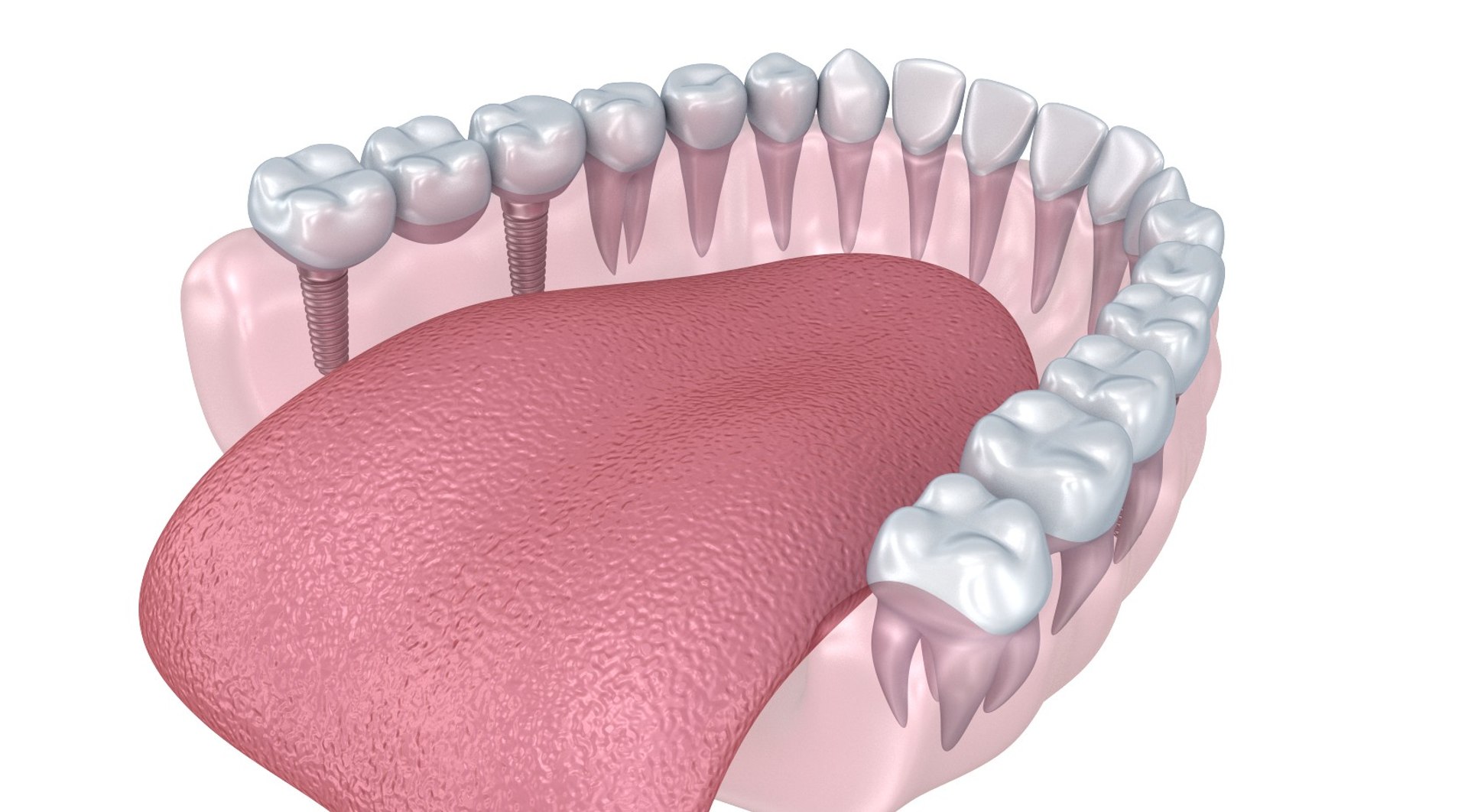 Lower Teeth Crown Dental 3d Max