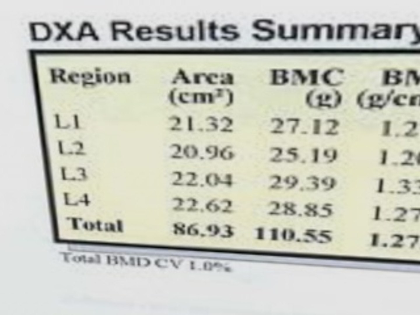 3dsmax Hologic Bone Densitometer