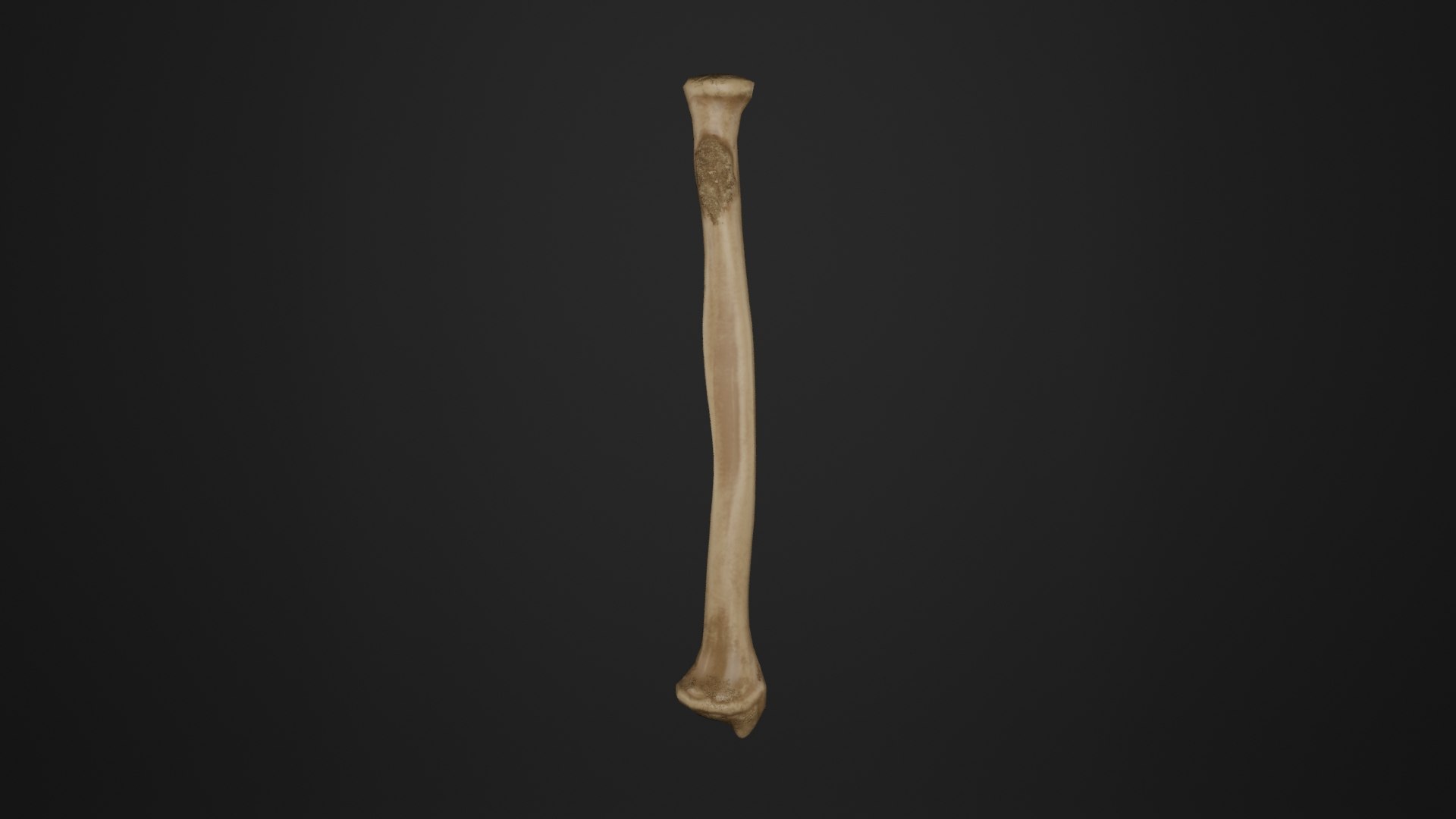 Human Anatomy-Radius Bone 3D - TurboSquid 2217113