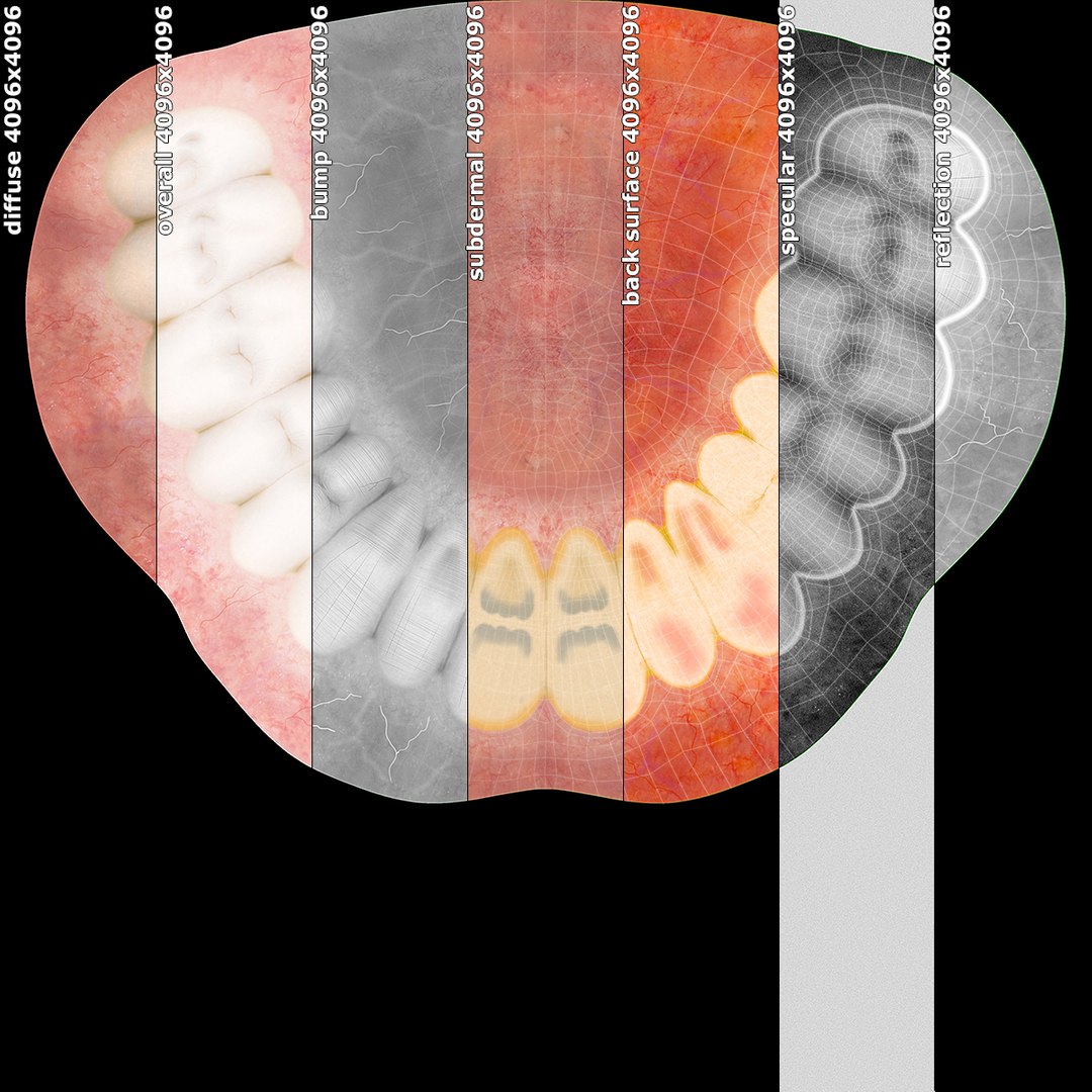 3dsmax Realistic Orthodontics