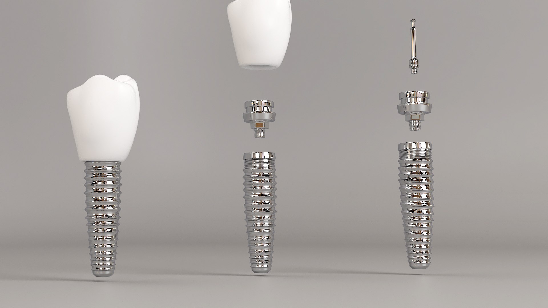 3D Dental Implant - TurboSquid 2152317