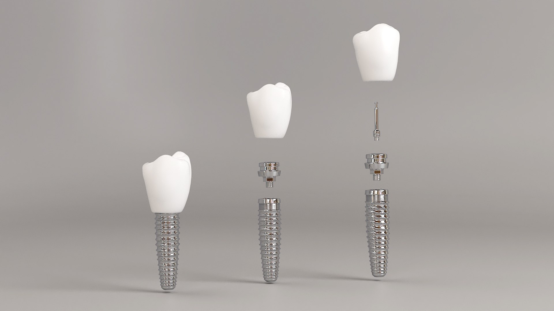 3D Dental Implant - TurboSquid 2152317