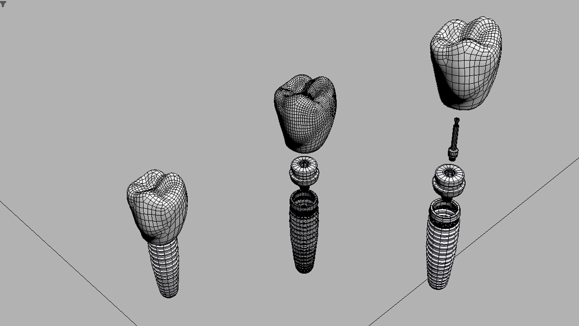 3D Dental Implant - TurboSquid 2152317