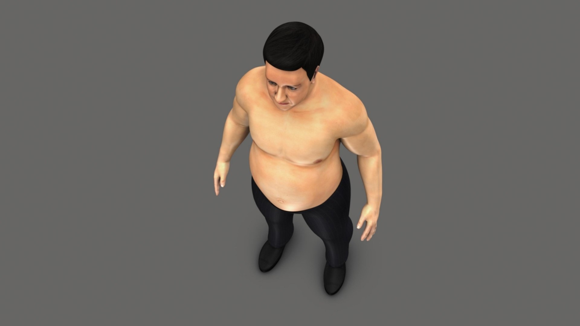 3D Obesity Body Mass - TurboSquid 1261529
