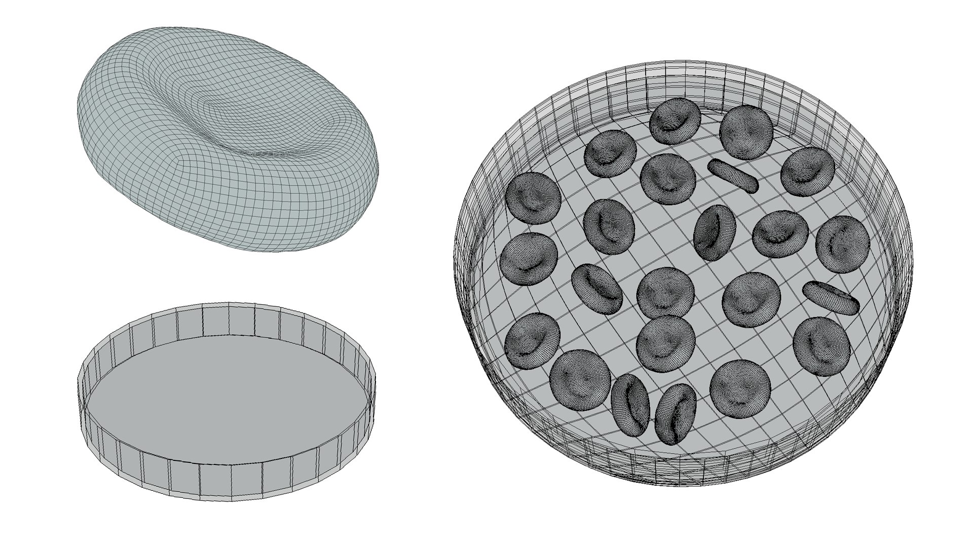 3D Normal Blood Cells vs Anemia model - TurboSquid 2142331