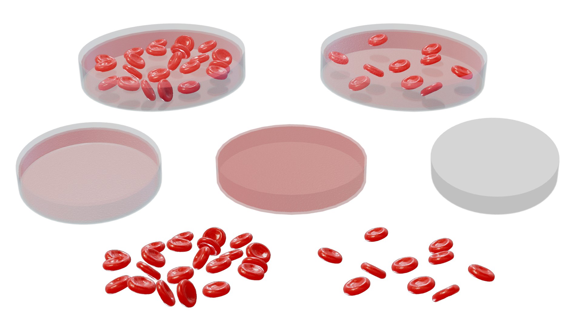 3D Normal Blood Cells vs Anemia model - TurboSquid 2142331