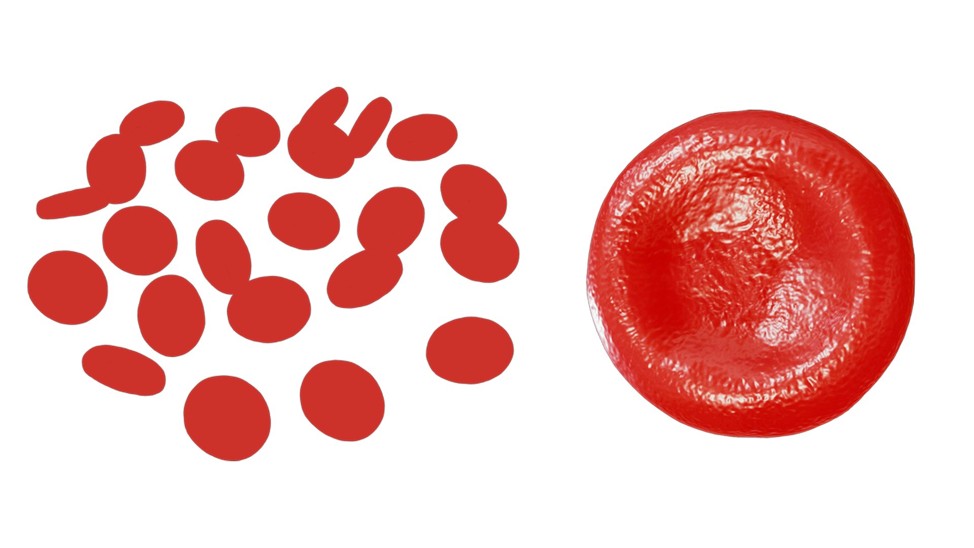 3D Normal Blood Cells vs Anemia model - TurboSquid 2142331
