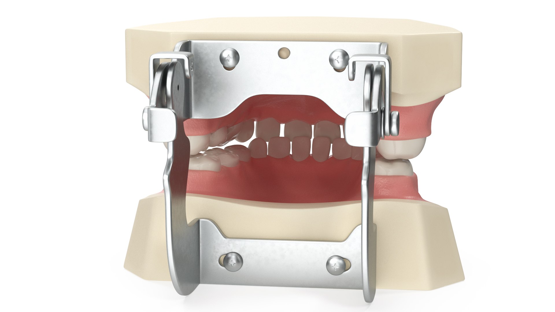 3D Manikin Dental Typodont Pediatric Model With Removable Overbite ...