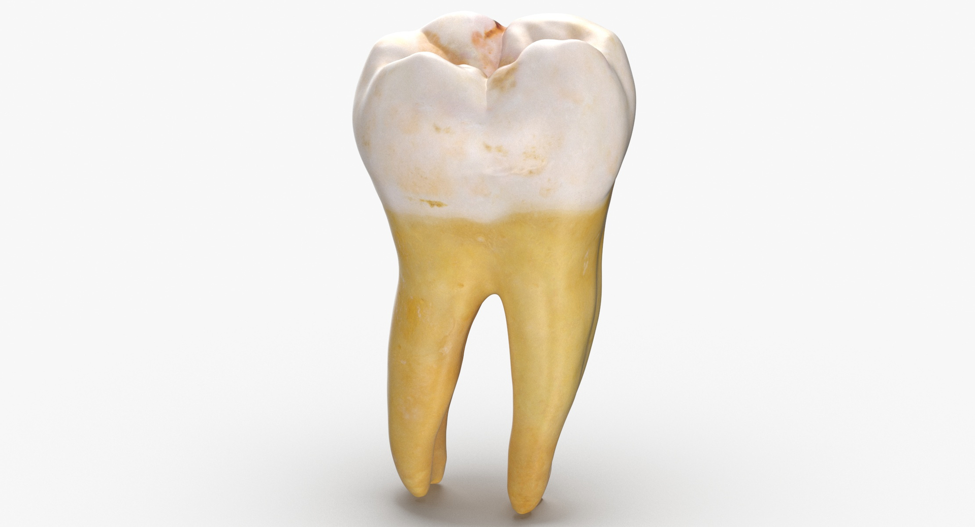 Human Lower Jaw Molars Teeth Clean and Damaged Collection - 7 models ...