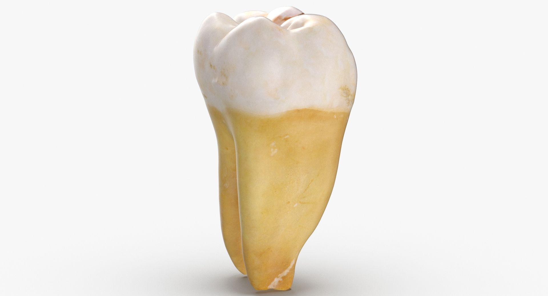 Human Lower Jaw Molars Teeth Clean and Damaged Collection - 7 models ...