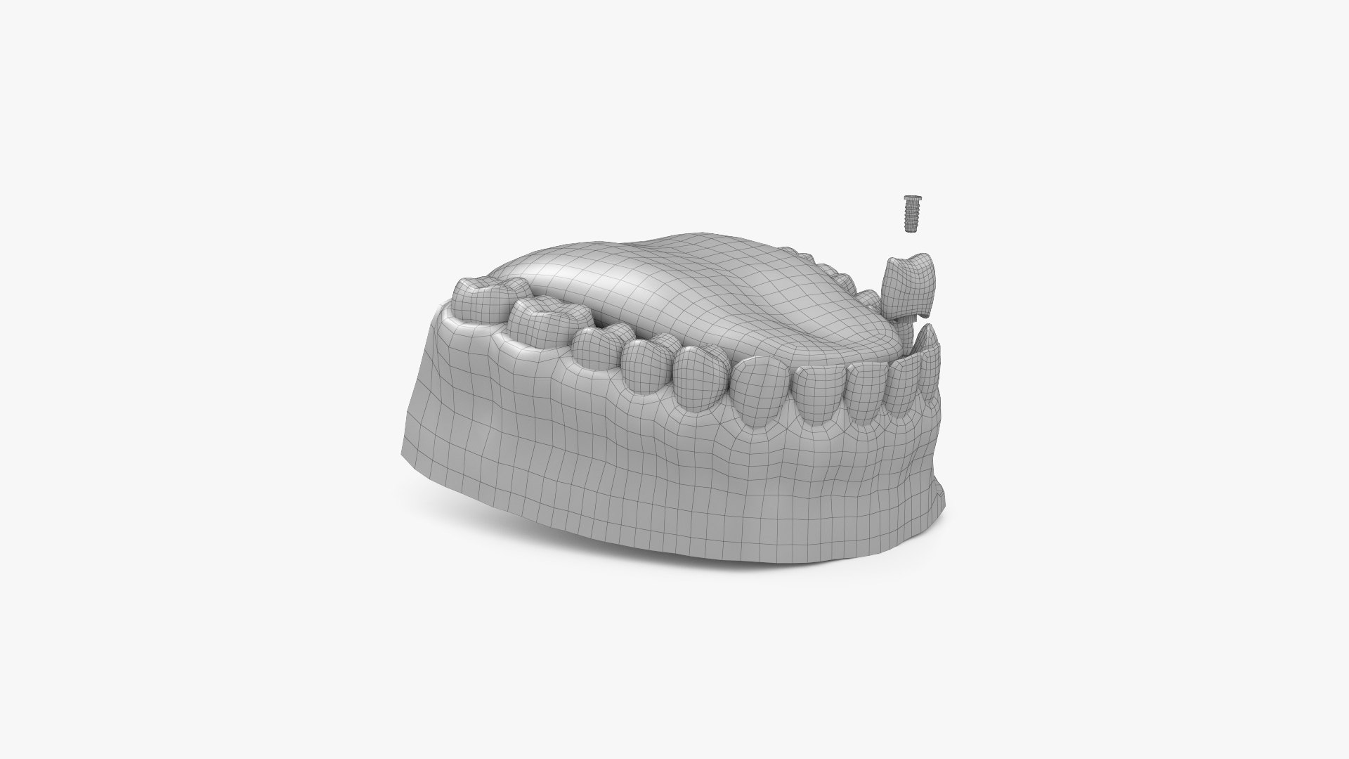 Dental Implant 3D model - TurboSquid 2181521