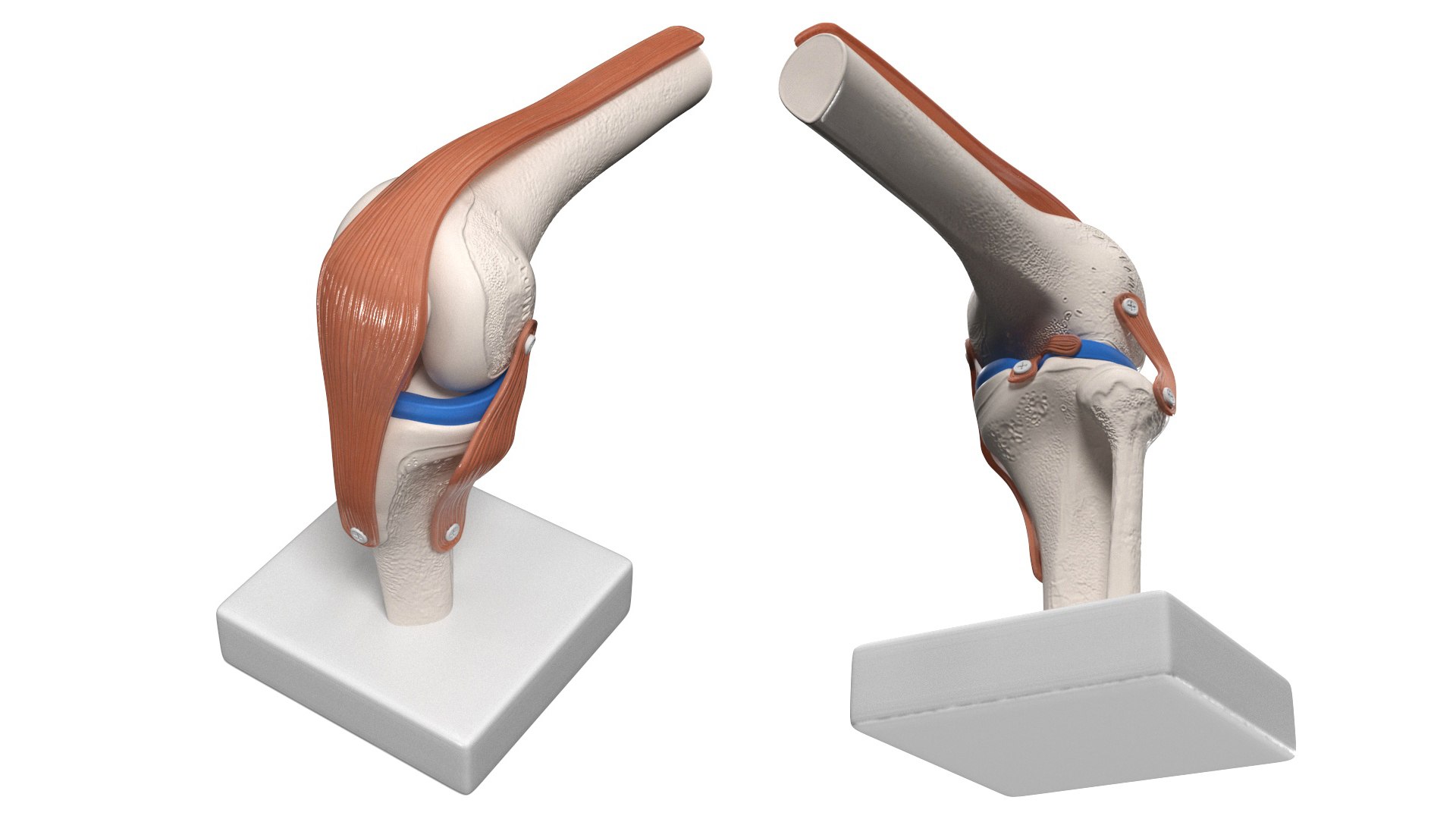 3D Knee Joint Model In Flexed Position - TurboSquid 2279792