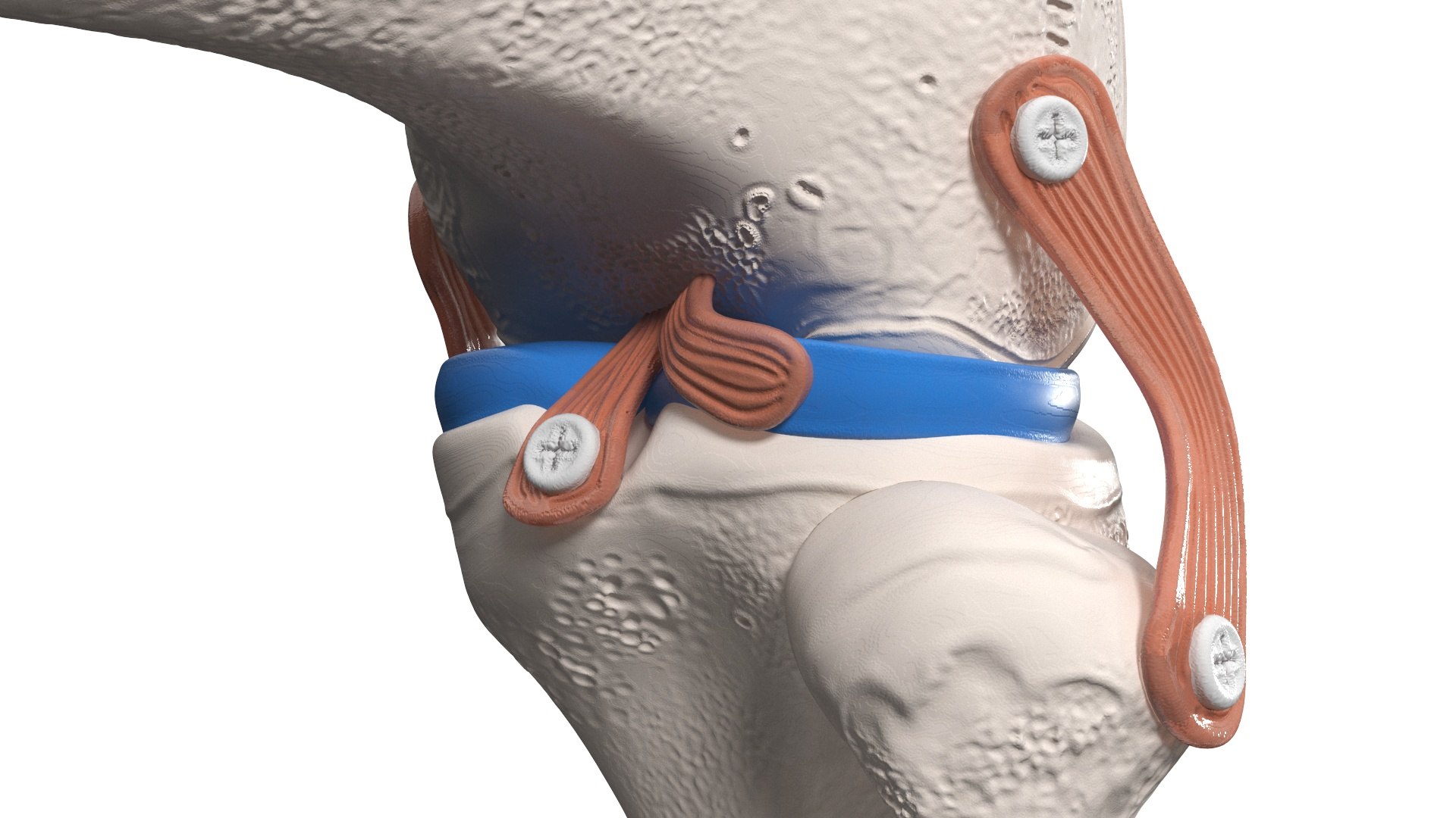 3D Knee Joint Model In Flexed Position - TurboSquid 2279792