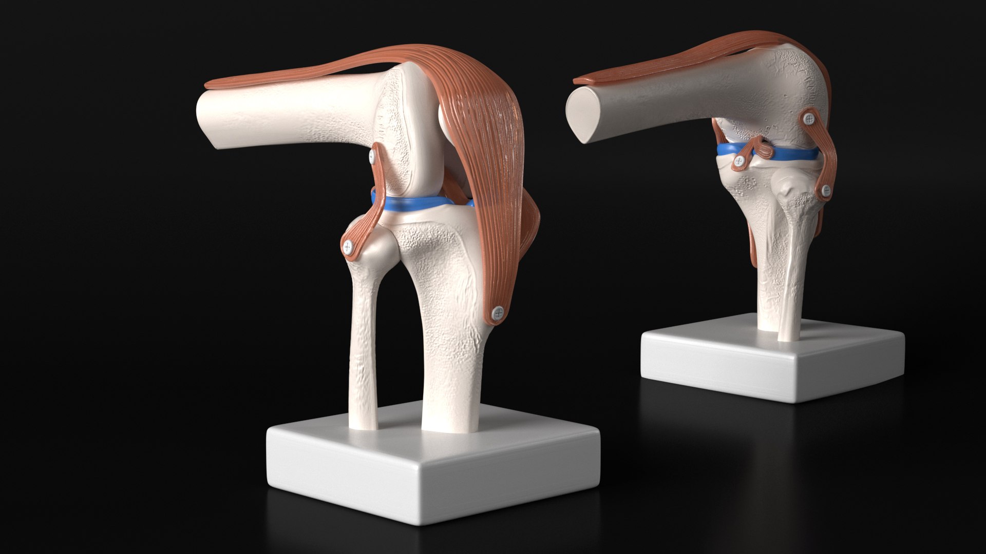 3D Knee Joint Model In Flexed Position - TurboSquid 2279792