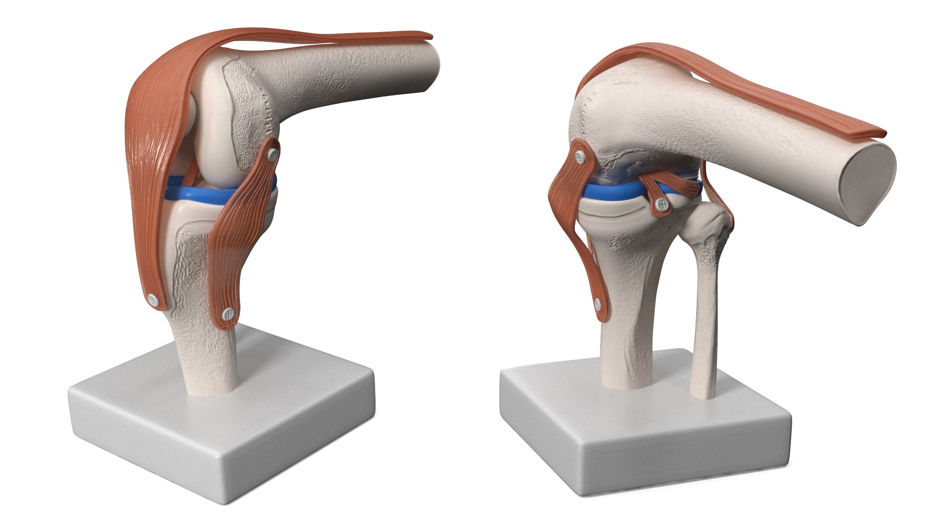 3D Knee Joint Model In Flexed Position - TurboSquid 2279792