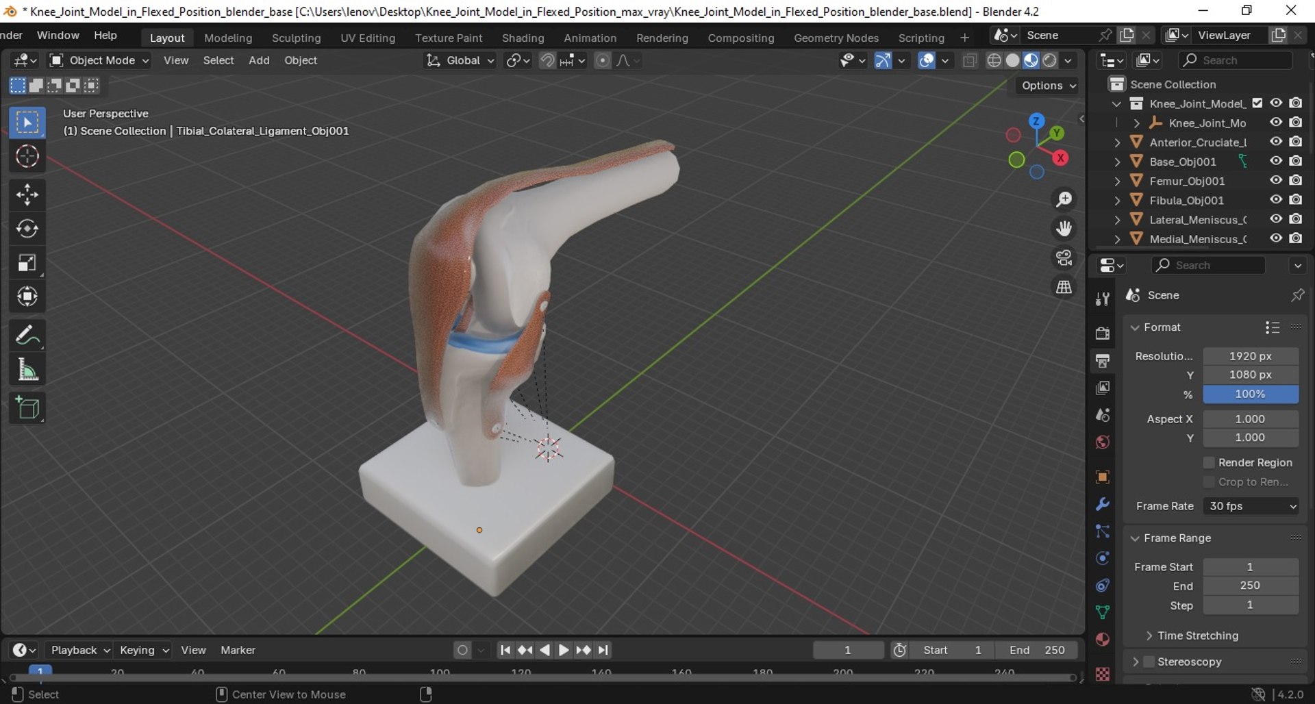 3D Knee Joint Model In Flexed Position - TurboSquid 2279792