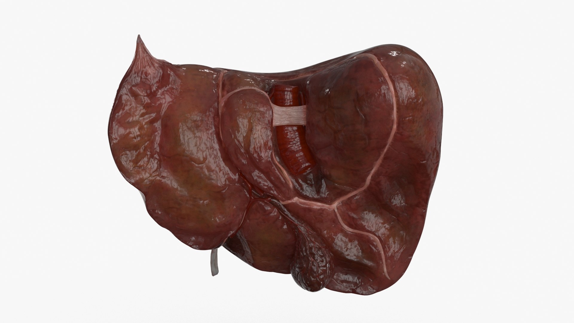 Gall Bladder Liver 3D Model - TurboSquid 1674886