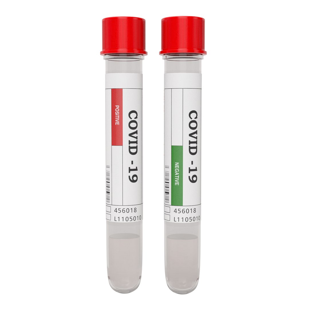 3D coronavirus pcr test results model - TurboSquid 1542803