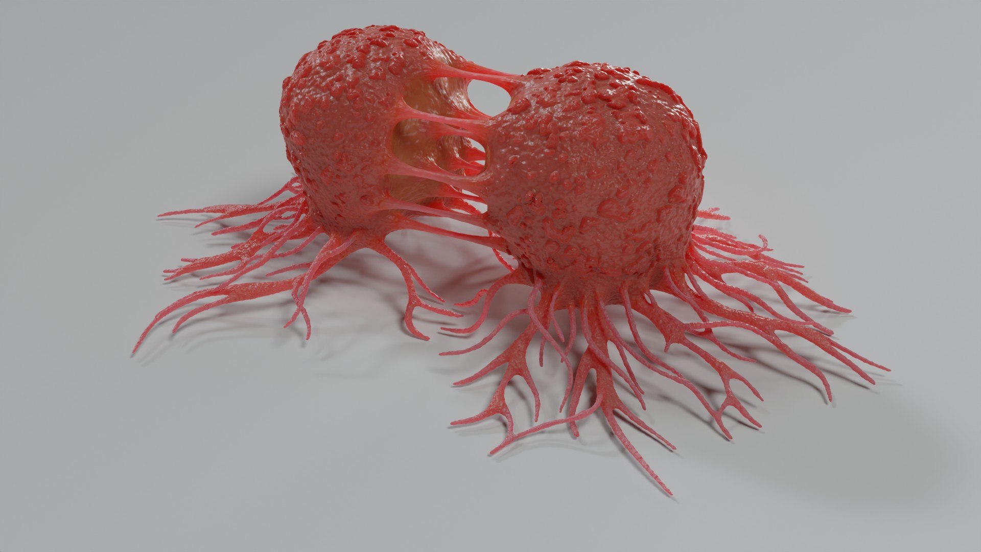 Tumors 3D model - TurboSquid 2159319