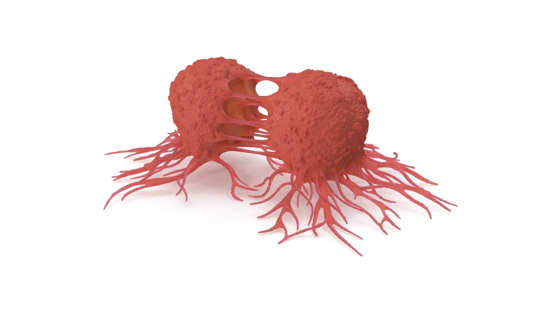 Tumors 3D model - TurboSquid 2159319