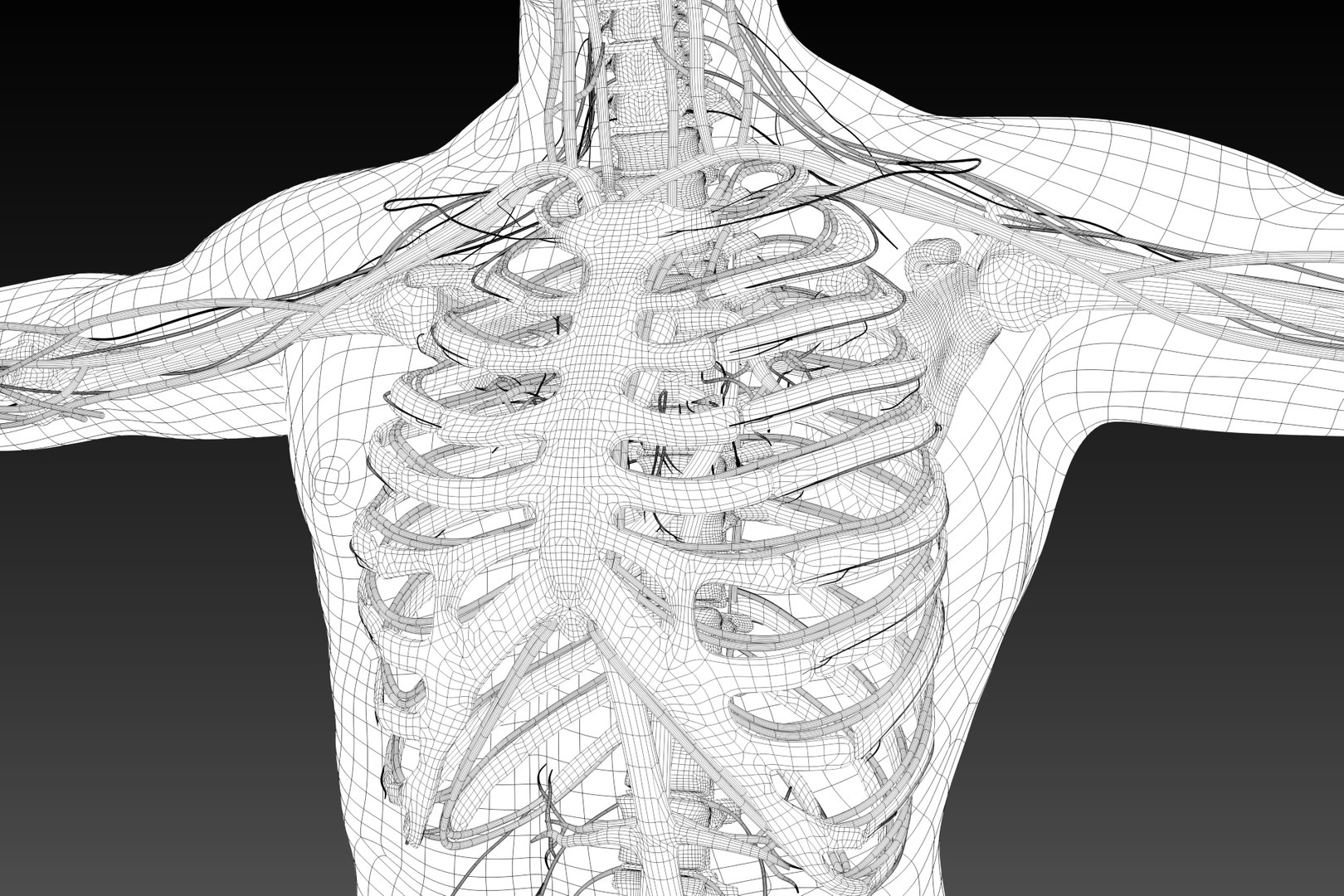 3D Human Perspective X-ray X-ray Bone Vascular Channels And Collaterals ...