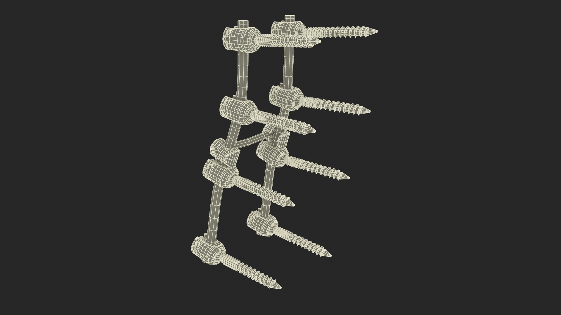 Lumbar Cervical Spine Fixation System Colored 3D Model - TurboSquid 2205810
