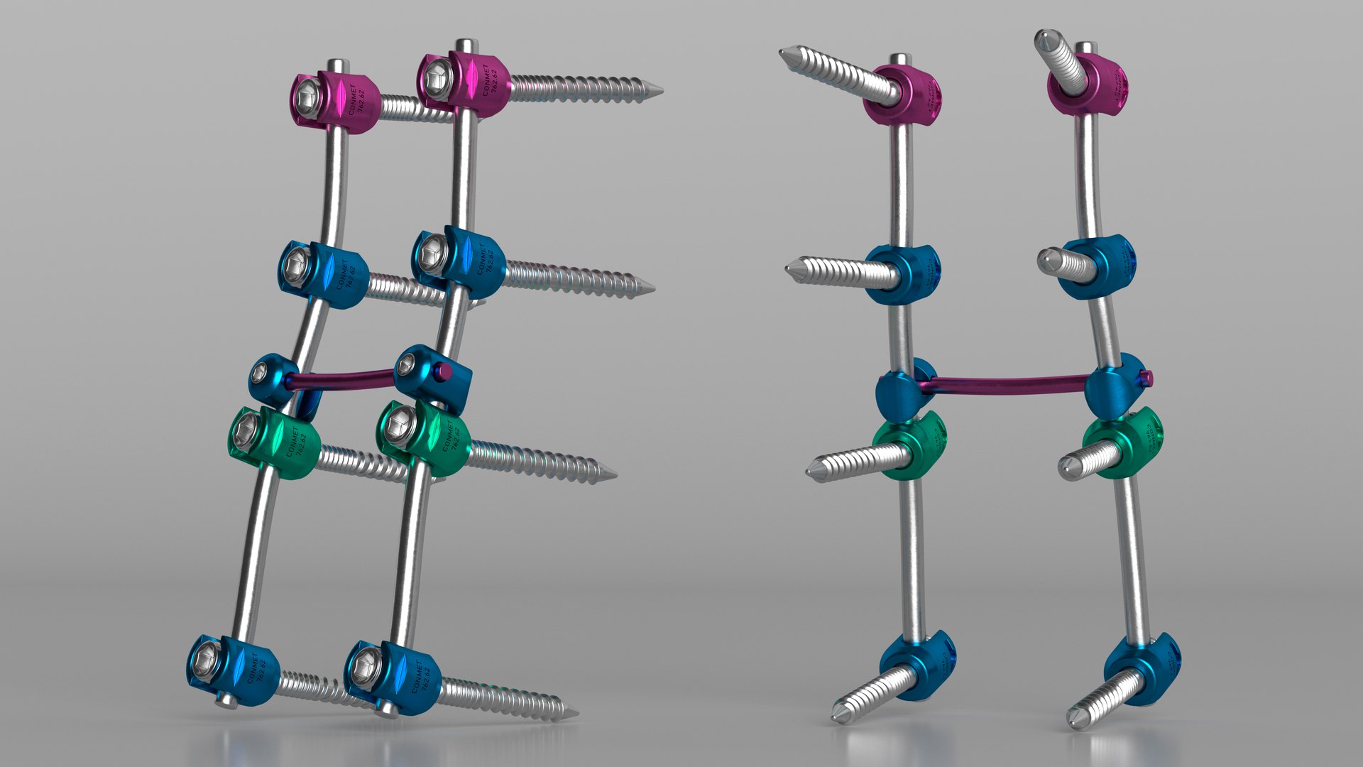 Lumbar Cervical Spine Fixation System Colored 3D Model - TurboSquid 2205810