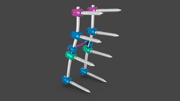modelo 3d Sistema de fijación lumbar de la columna cervical de color ...