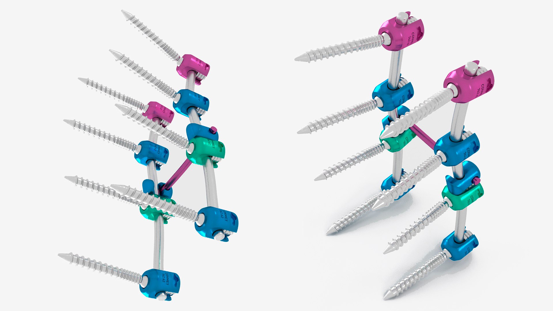 Lumbar Cervical Spine Fixation System Colored 3D Model - TurboSquid 2205810